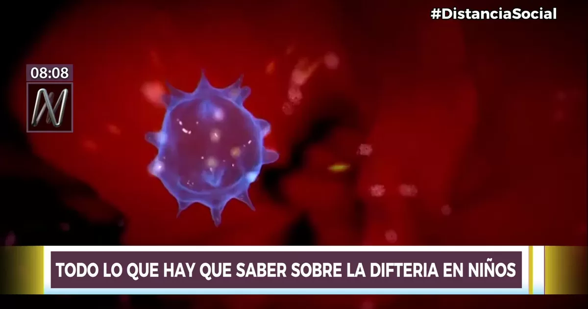 Difteria en niños: Todo lo que hay que saber sobre esta enfermedad