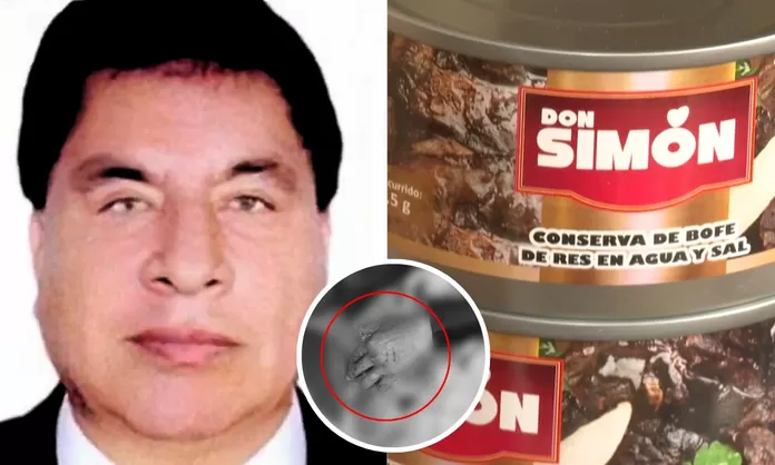 Nilo Burga: ¿Por qué se cuestionan los resultados de necropsia? | Canal N