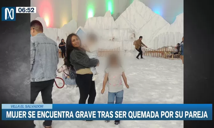 Villa El Salvador: Mujer quemada por su pareja lucha por su vida | Canal N