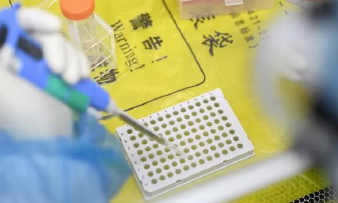 COVID-19: Medicamento REGN-COV2 contra el coronavirus entra en fase ...