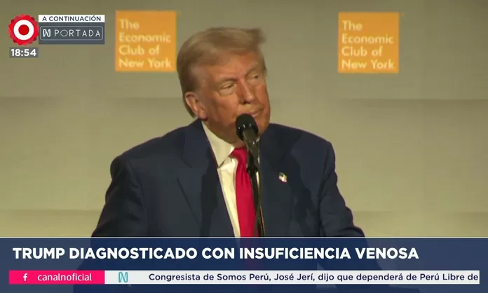 Donald Trump es diagnosticado con insuficiencia venosa crónica | Canal N